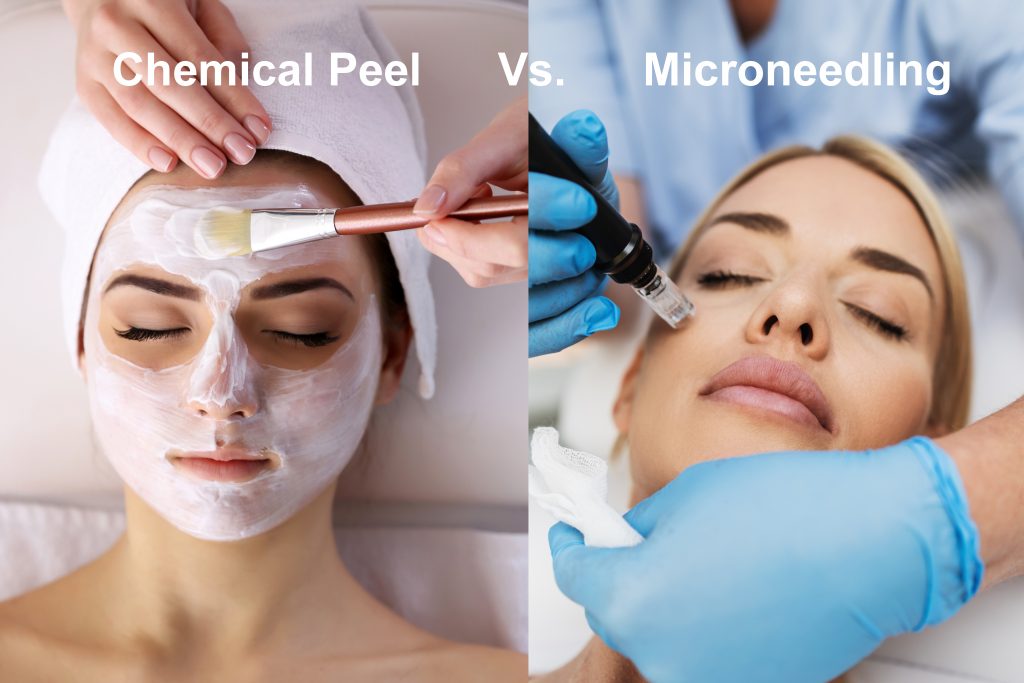 Microneedling Vs Chemical Peel - Which Is Better?